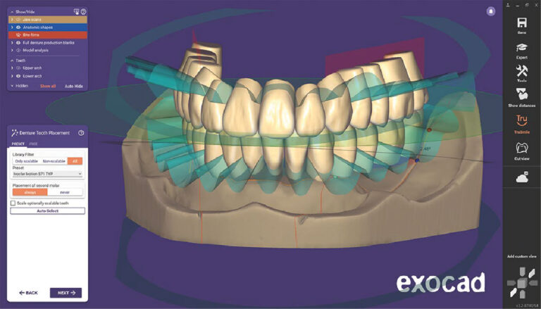 Exocad - S.I.N. 360